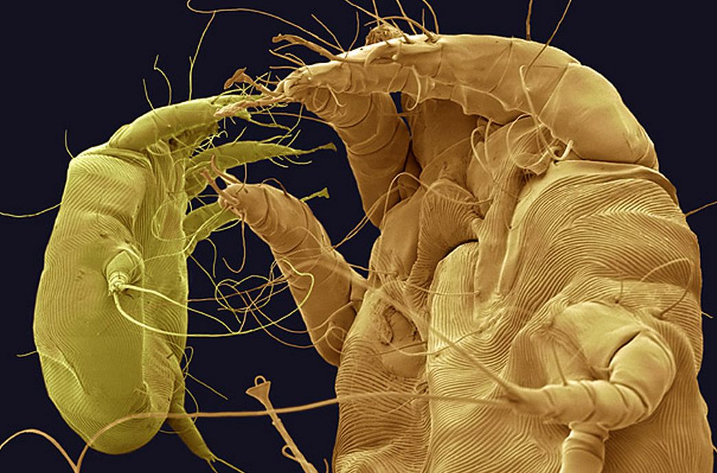 Electron Microscopic scans of the insects among us – Motley News