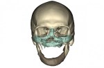 First Face Transplant Gives an Amazing Transformation | Photos – Motley ...
